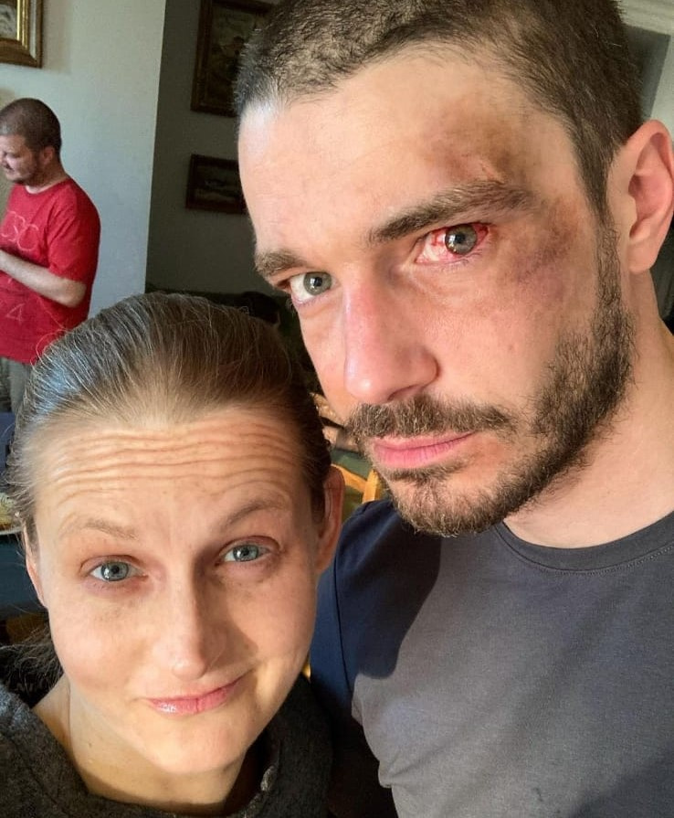 Бывшая жена Максима Матвеева попала в «топ самых некрасивых артисток России» | STARHIT